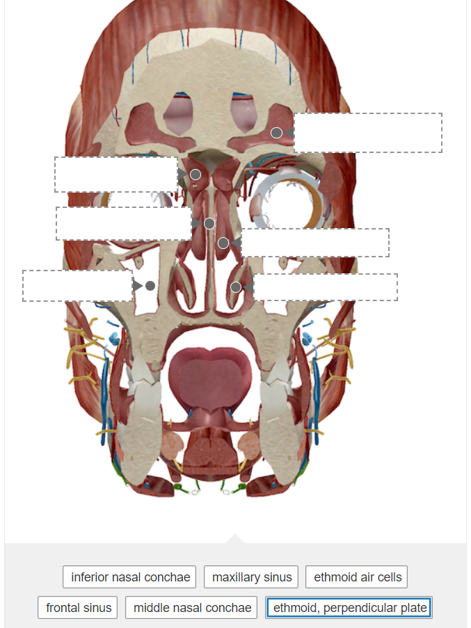 Solved Label the image. | Chegg.com