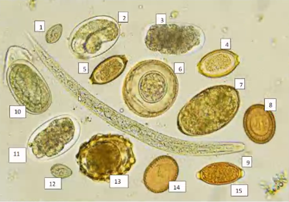 Solved IDENTIFY THE TYPE OF HELMINTH EGGS (EXACT NAME OF THE | Chegg.com