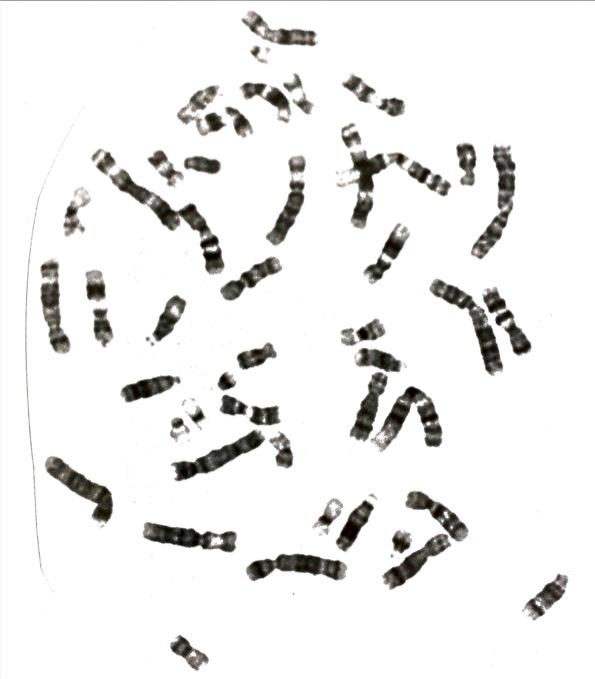 Label and identify the chromosomes on this karyotype | Chegg.com