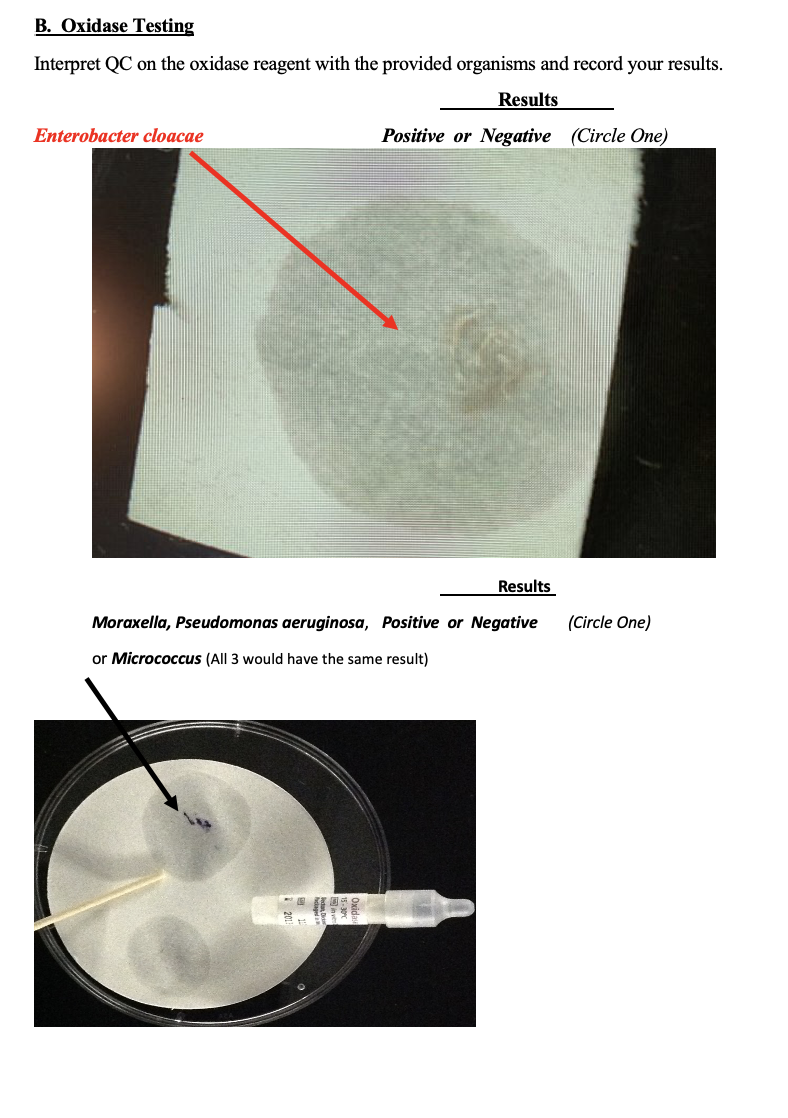 Solved B. Oxidase Testing Interpret QC on the oxidase | Chegg.com