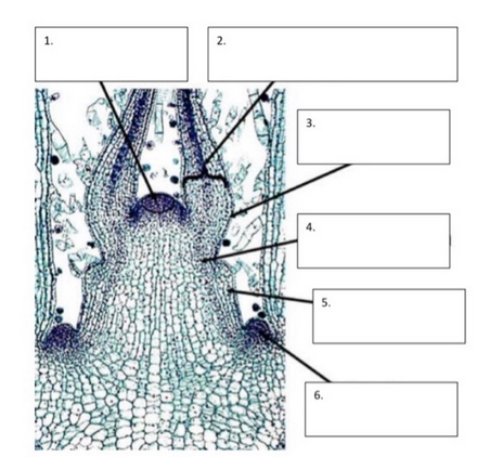 Solved Label the following: Label numbers 1 to 6: (a few | Chegg.com