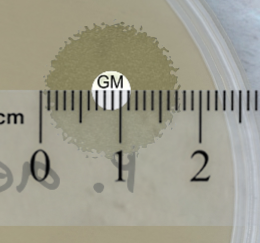 PHASE 3: Measure inhibition zones for P aeruginosa | Chegg.com