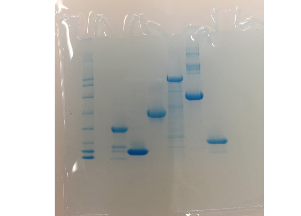 In a biochemistry lab, SDS-PAGE was done. The | Chegg.com