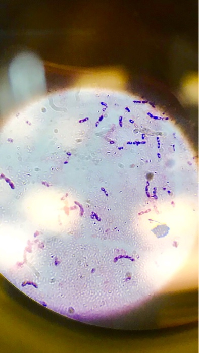 Solved Unknown bacteria , which one is it? Unknown bacteria | Chegg.com