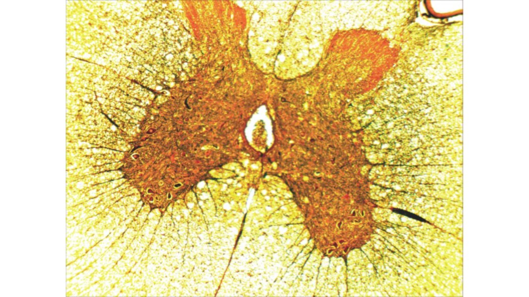 Solved Note: The colors of the tissue (white and gray) have | Chegg.com