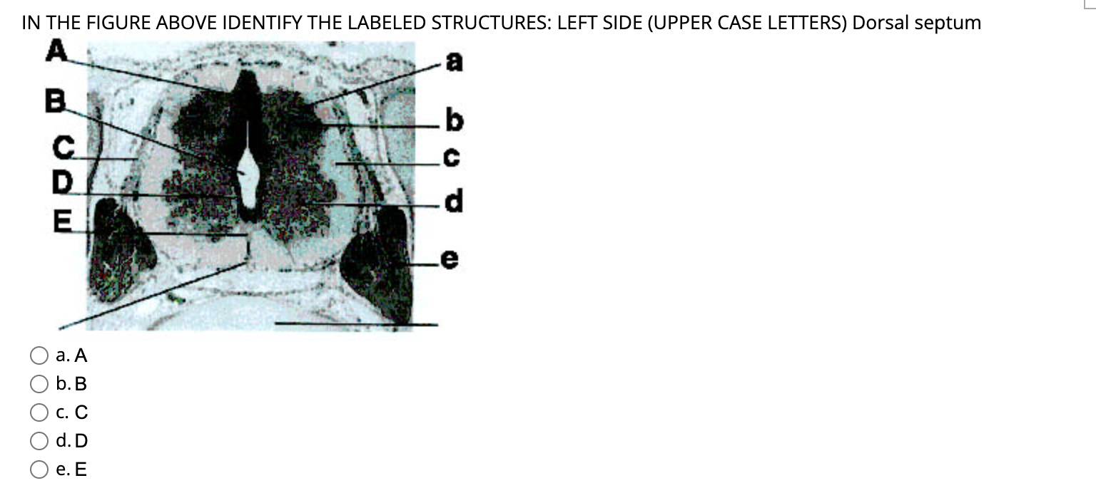 IN THE FIGURE ABOVE IDENTIFY THE LABELED STRUCTURES: | Chegg.com