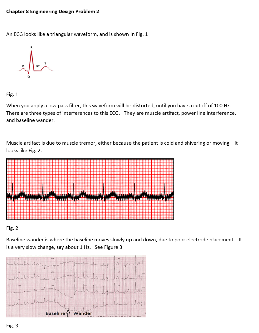 Solved Chapter 8 Engineering Design Problem 2 An ECG looks | Chegg.com
