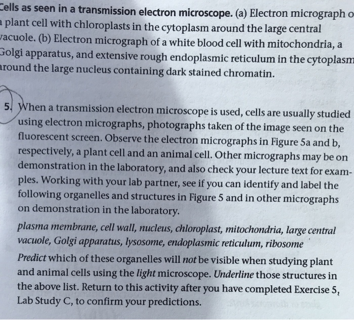 ells as seen in a transmission electron microscope. | Chegg.com