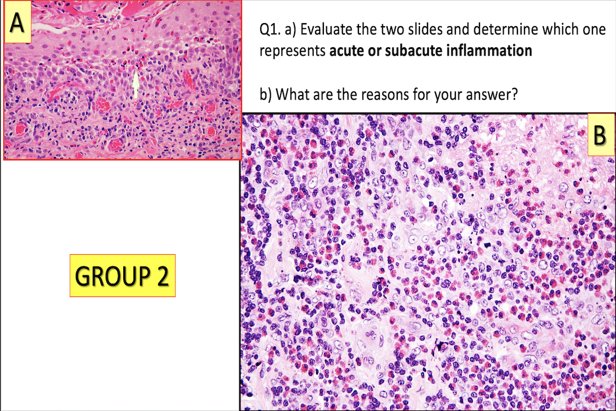 Solved A Q1. a) Evaluate the two slides and determine which | Chegg.com