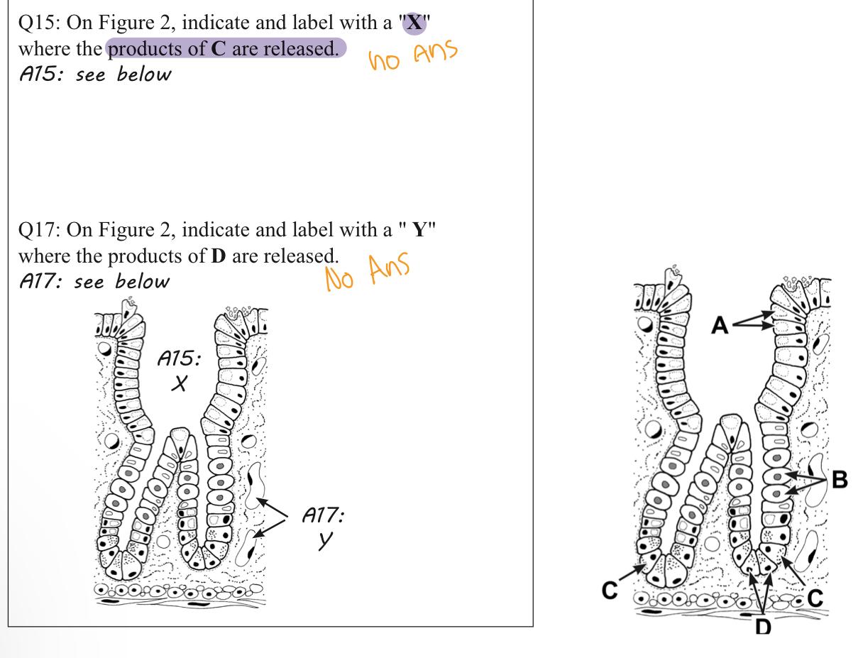Solved Q15: On Figure 2, indicate and label with a " " | Chegg.com