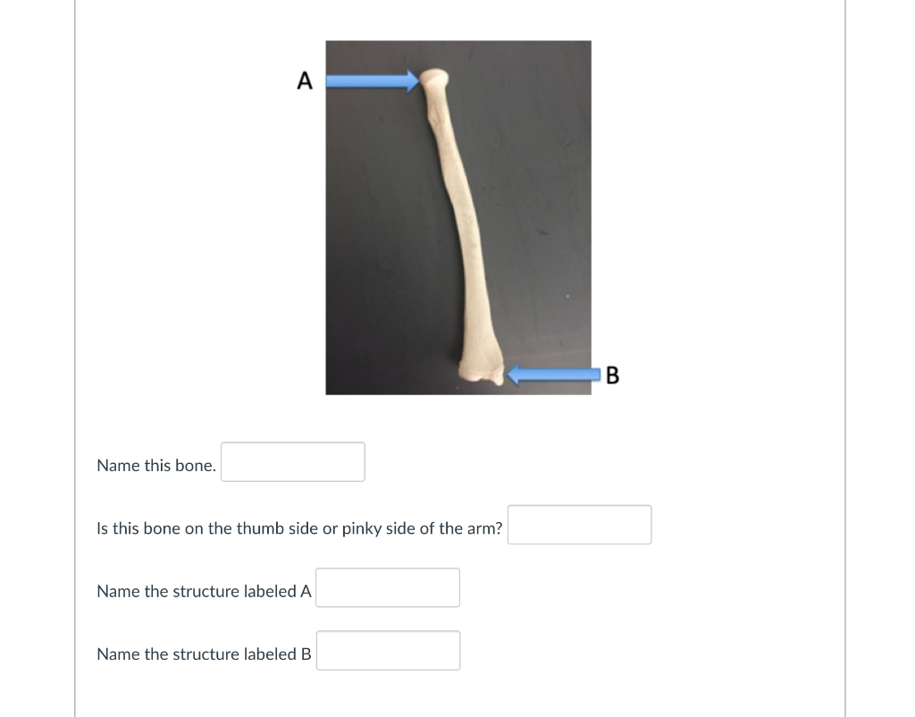 Name this bone. Is this bone on the thumb side or | Chegg.com