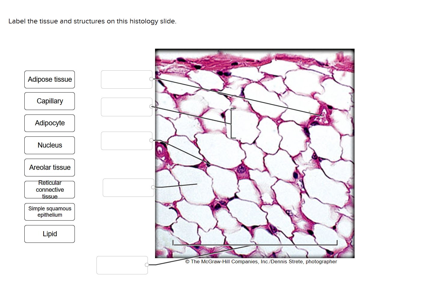 Solved Label the tissue and structures on this histology | Chegg.com