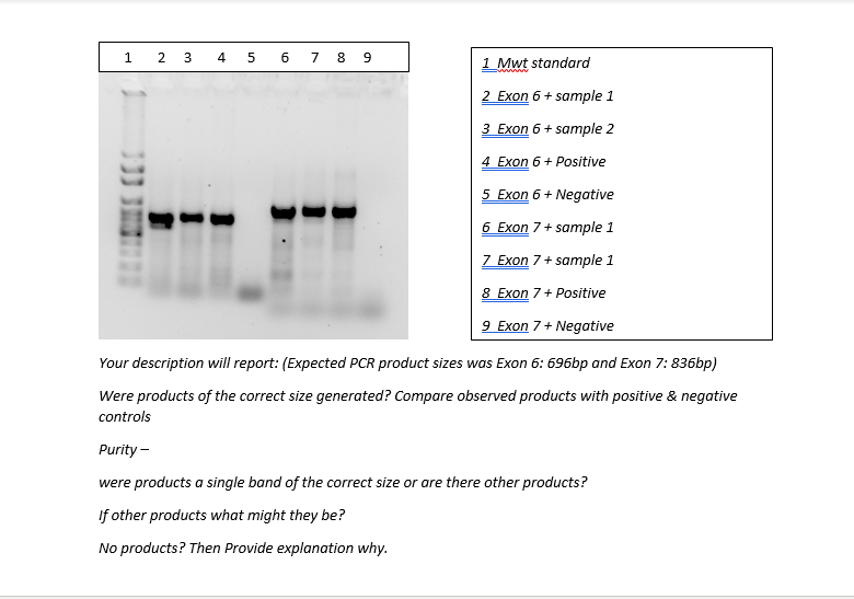 Solved 1 2 3 4 5 6 7 8 9 1 Mwt standard 2 Exon 6 + sample 1 | Chegg.com