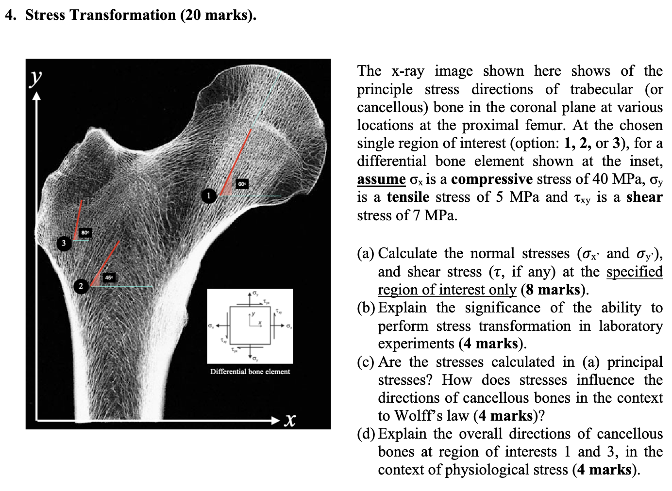 Solved 4. Stress Transformation (20 marks). The x-ray image | Chegg.com