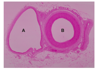 Solved Figure 7 shows a cross-section of two blood vessels | Chegg.com