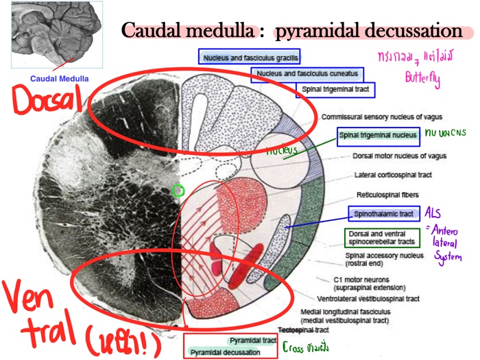 Rostral Medulla Cross Section