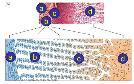 Solved The diagram below of the hypophyseal plate is | Chegg.com