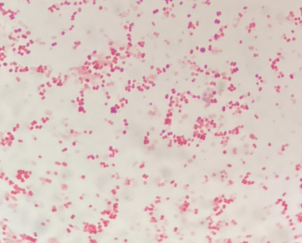 Solved what is the gram stain result? Be specific.List | Chegg.com
