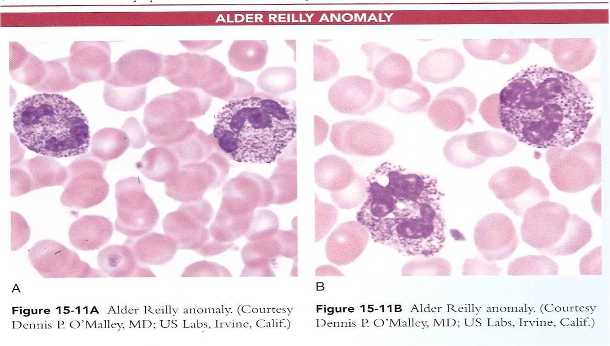 Alder Reilly Vs Toxic Granulation