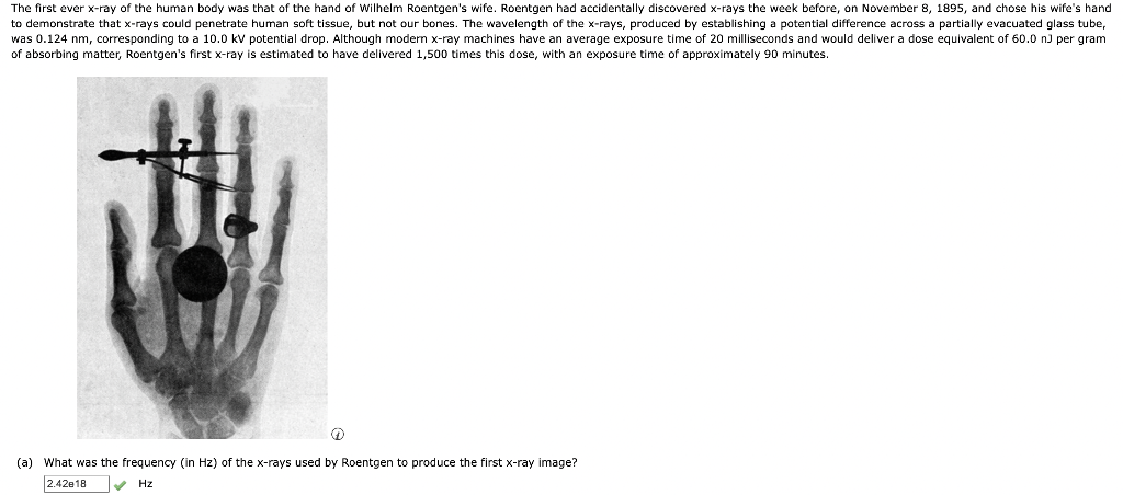 Solved The first ever x-ray of the human body was that of | Chegg.com