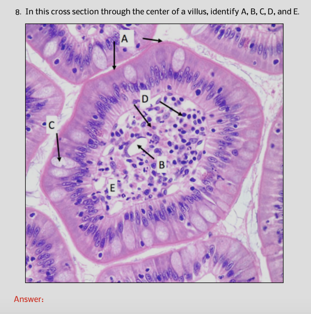 Solved 8. In this cross section through the center of a | Chegg.com