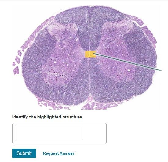 Solved Identify the highlighted structure. Submit Request | Chegg.com