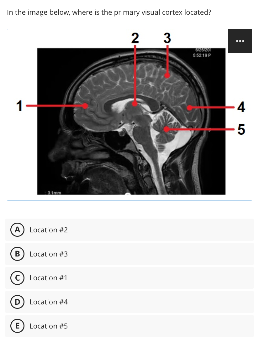 Solved In the image below, where is the primary visual | Chegg.com