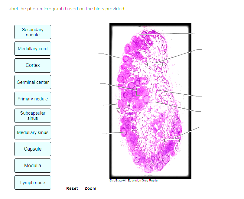 Label the photomicrograph based on the hints | Chegg.com