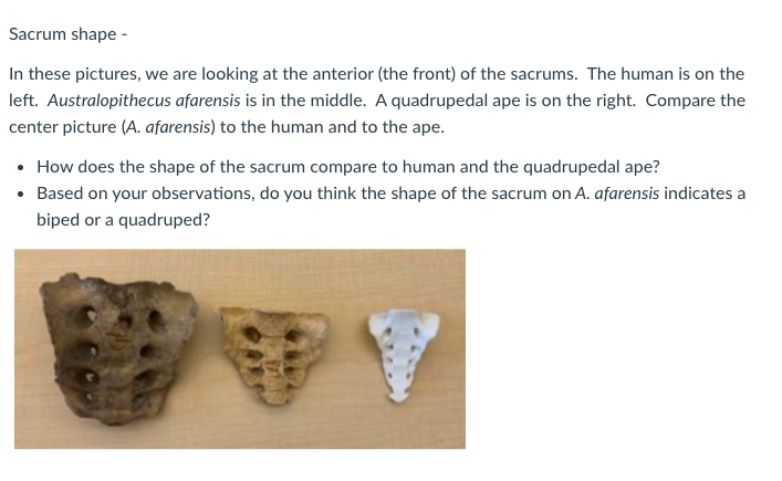 Sacrum shape - In these pictures, we are looking at | Chegg.com