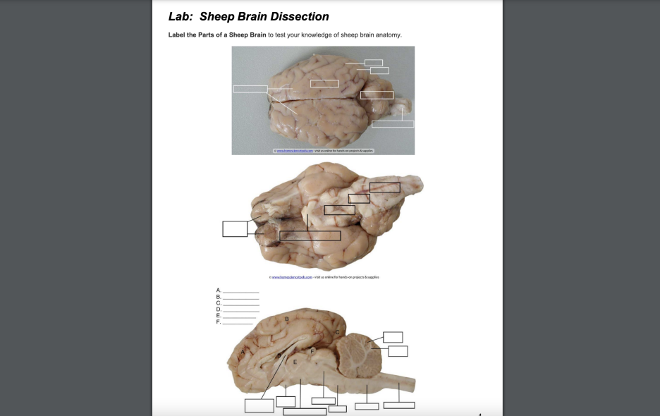 Solved Lab: Sheep Brain Dissection Label the | Chegg.com