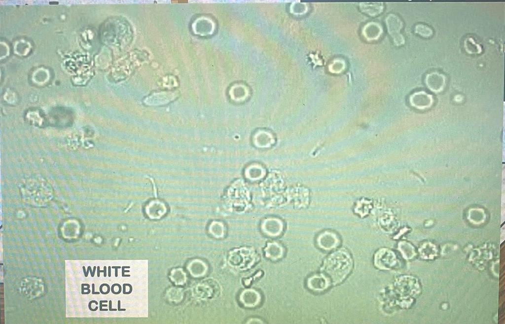 Solved # of white blood cells? normal or abnormal range? | Chegg.com