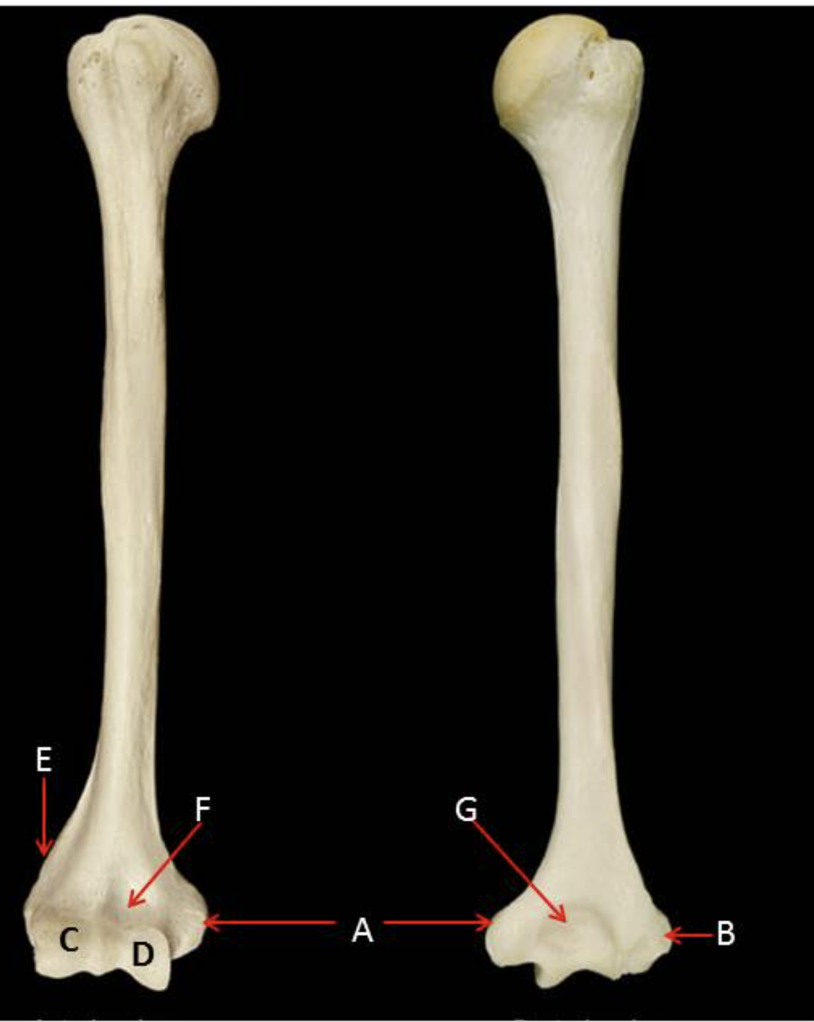 Solved Identify and label the following bony features of the | Chegg.com