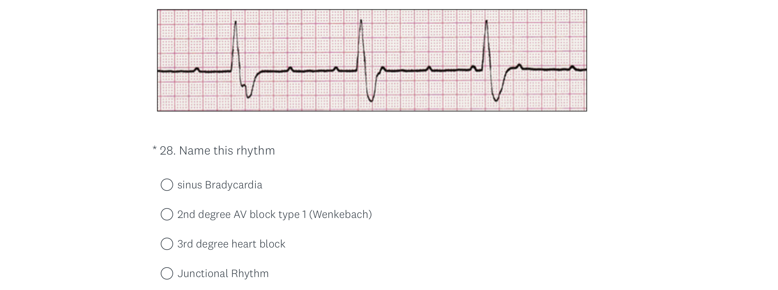 Solved Atrial fibrillation Sinus Rhythm with PJC Sinus | Chegg.com