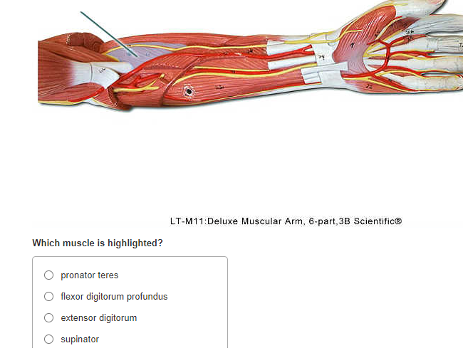 Solved LT-M11 Deluxe Muscular Arm, 6-part 3B Scientific® | Chegg.com