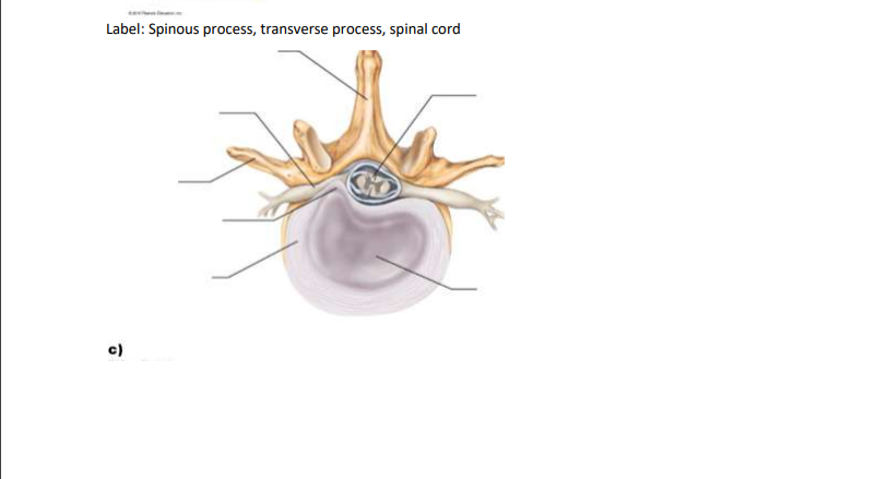 Solved Label: Spinous process, transverse process, spinal | Chegg.com