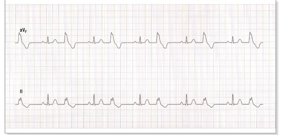 Solved What is the name/interpretation of this | Chegg.com Solved What is the name/interpretation of this | Chegg.com