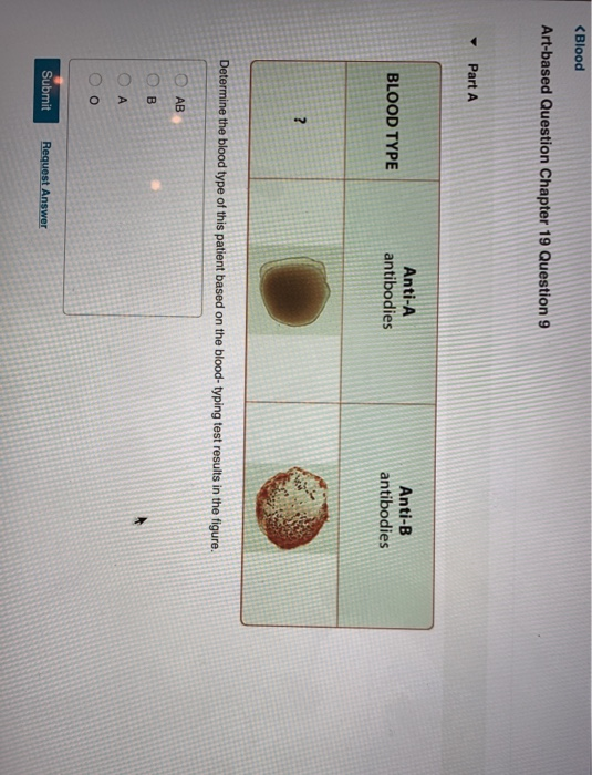 Solved Blood Art-based Question Chapter 19 Question 9 Part A | Chegg.com