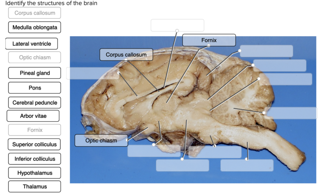 Solved Identify the structures of the brain Corpus callosum | Chegg.com