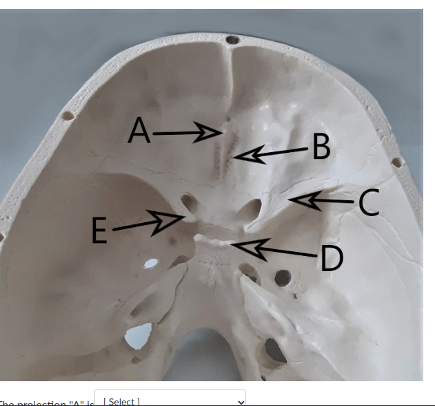 Solved 1.The projection "A" is [ Select ] ["zygomatic | Chegg.com