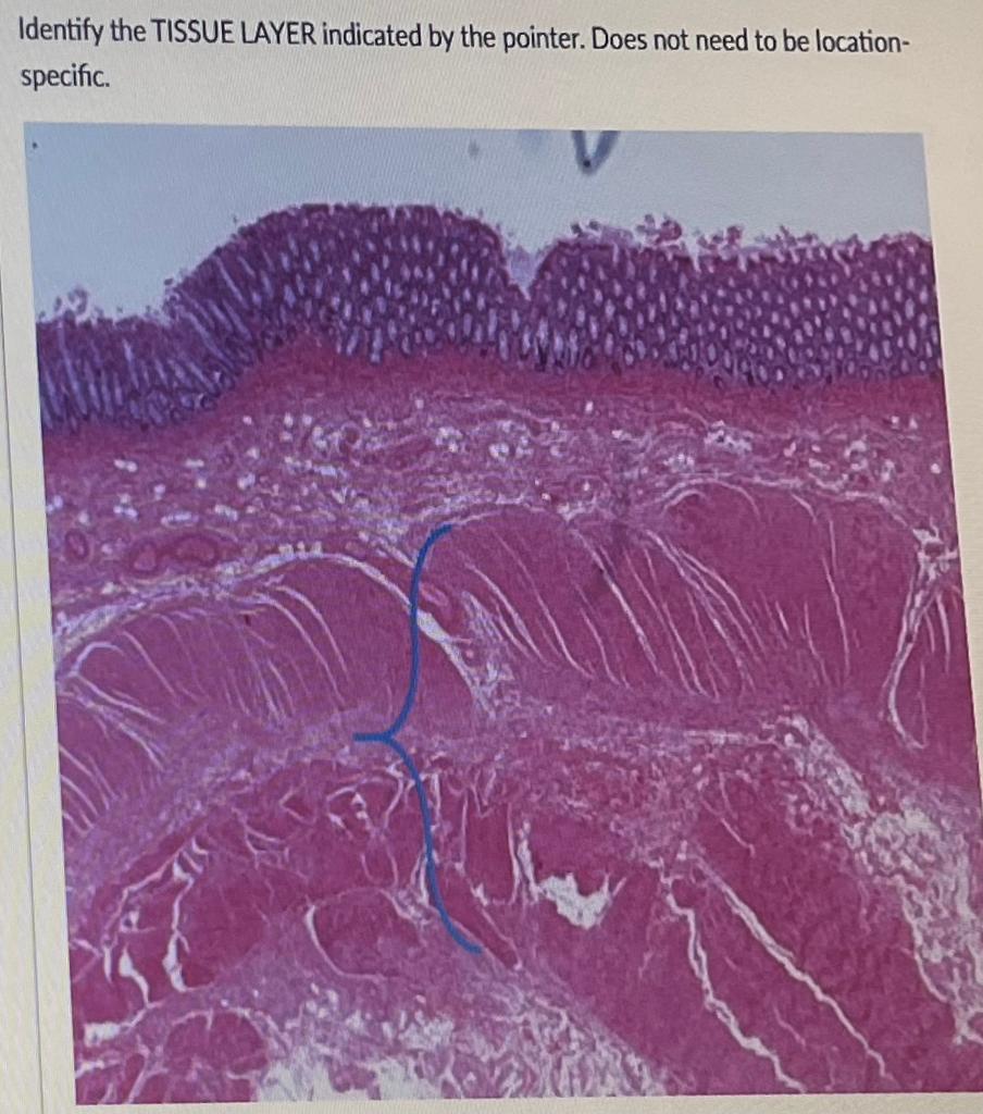 Identify the TISSUE LAYER indicated by the pointer. | Chegg.com