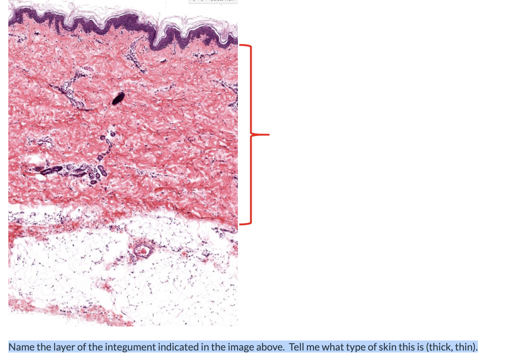 Solved Name the layer of the integument indicated in the | Chegg.com