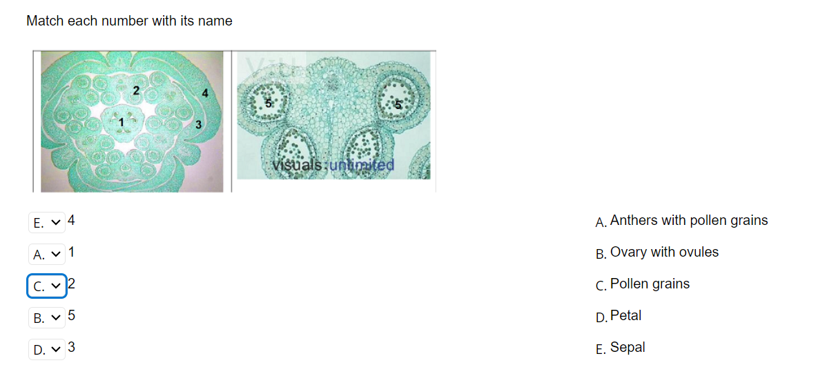 Solved Match each number with its name Match each number | Chegg.com