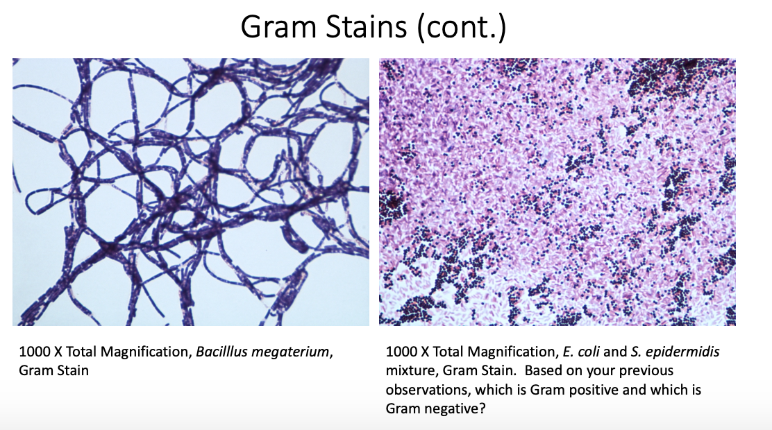 Solved Organism: Staphylococcus epidemm's Total | Chegg.com