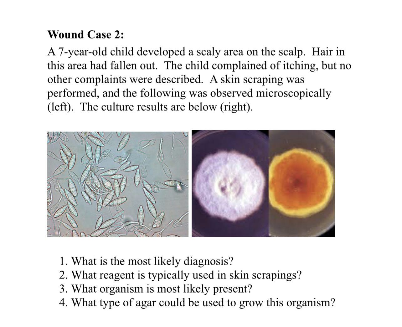 Wound Case 2:A 7-year-old child developed a scaly | Chegg.com