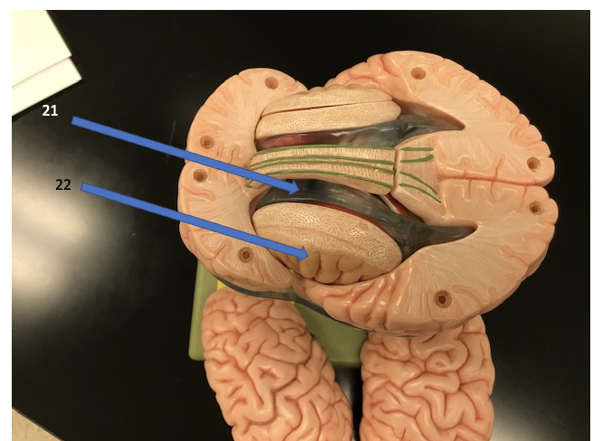 Solved brain anatomy | Chegg.com