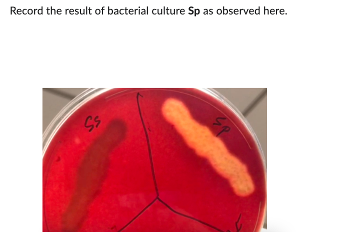 Solved Identify the biochemical test to differentiate Gram's | Chegg.com