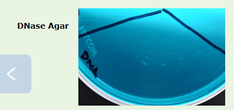 Solved DNase Agar a. Clearing or no clearing: b. | Chegg.com