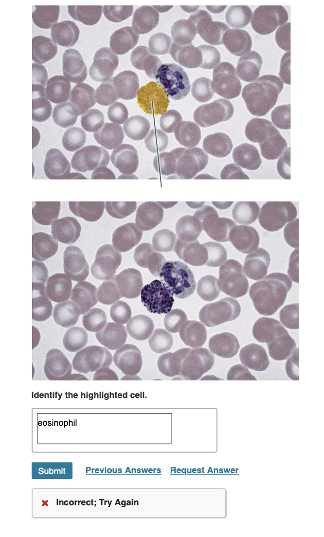 Solved Identify the highlighted cell. eosinophil Submit | Chegg.com