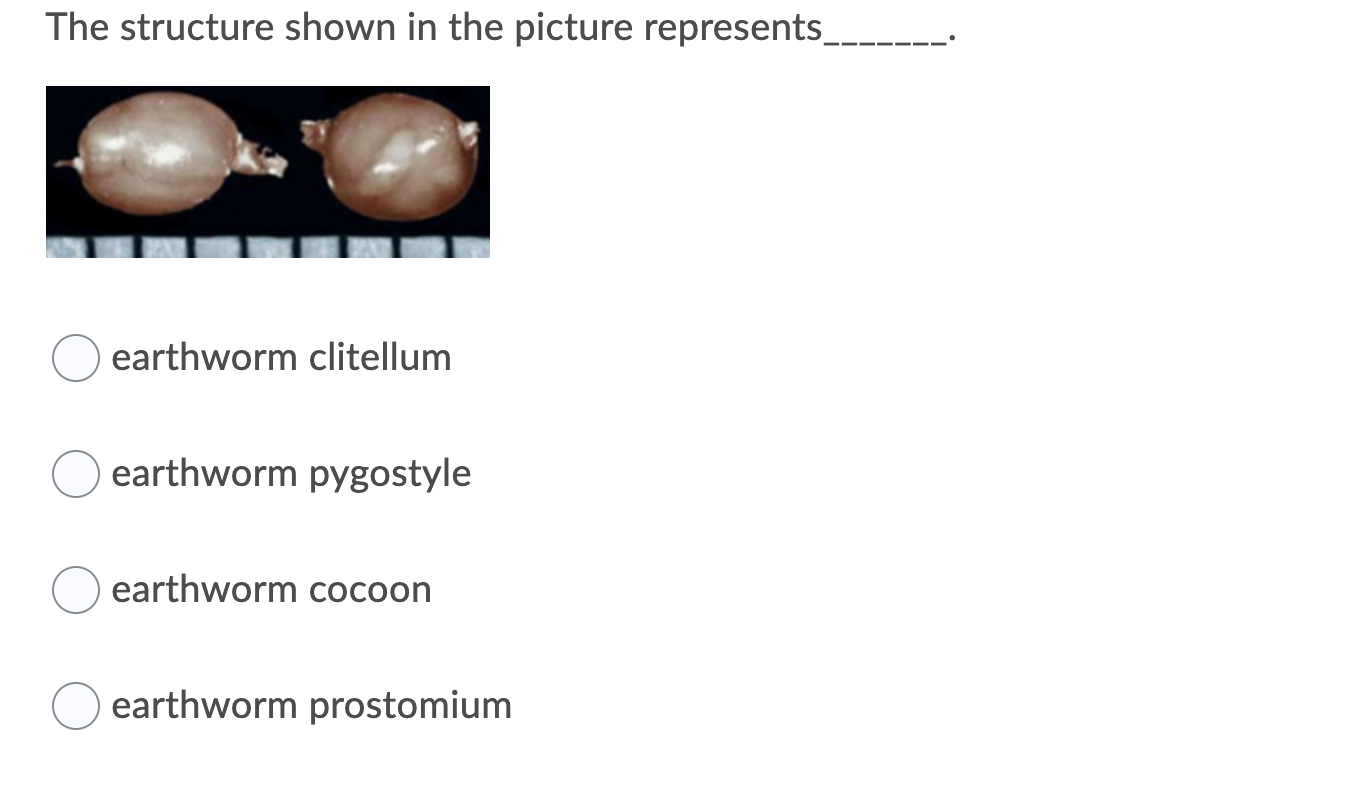 Solved The structure shown in the picture represents | Chegg.com