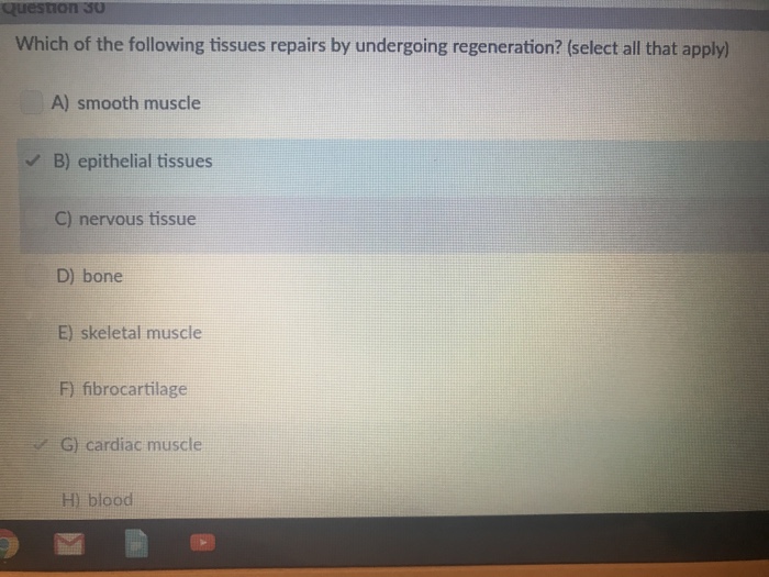 Solved Which of the following tissues repairs by undergoing | Chegg.com